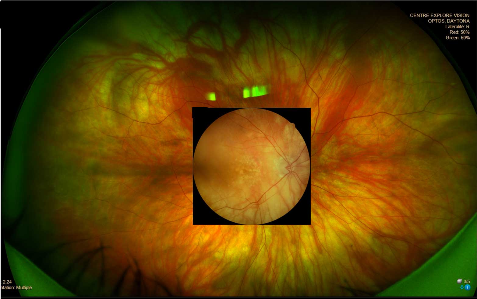 Nouveautés en imagerie - Mon Oeil