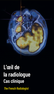 L'oeil de la radiologue - Mon Oeil